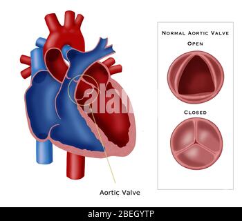 Normal Aortic Valve Stock Photo - Alamy