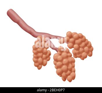 Alveoli Damaged By Emphysema Stock Photo - Alamy