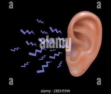 Sound Entering Human Outer Ear, Illustration Stock Photo - Alamy