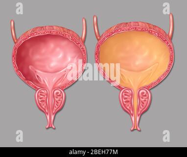 Empty and Full Bladder, Illustration Stock Photo - Alamy