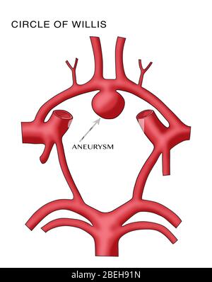 Circle of Willis, Illustration Stock Photo - Alamy