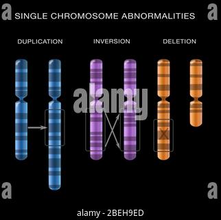 Single chromosome abnormalities. Chromosome inversion. Illustration ...