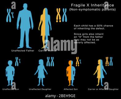 Fragile X Inheritance, Illustration Stock Photo - Alamy