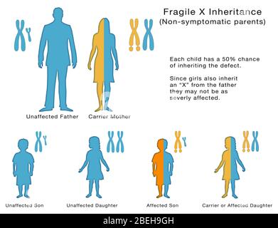 Fragile X Syndrome, Illustration Stock Photo - Alamy