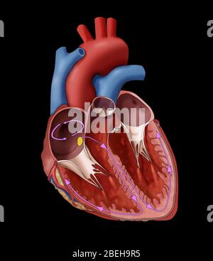 Atrial Flutter, Illustration Stock Photo - Alamy