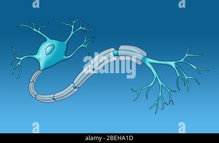 Illustration of a healthy nerve, with axon and myelin sheath, and its ...