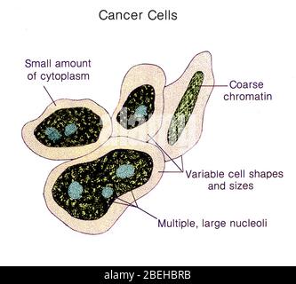 Cancer cells, illustration. Cancerous (malignant) cells divide rapidly ...