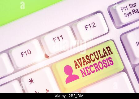 Conceptual hand writing showing Avascular Necrosis. Concept meaning ...