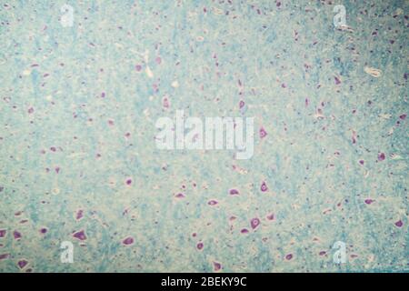 Nerve tissue under the microscope 100x Stock Photo - Alamy