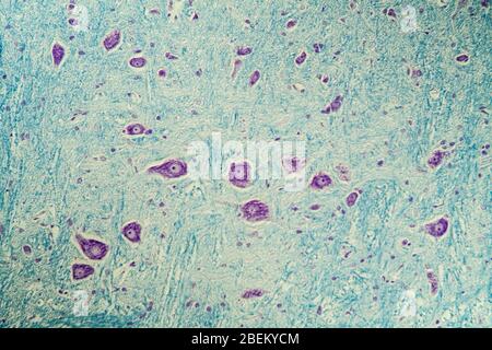 Nerve cells under the microscope 200x Stock Photo - Alamy