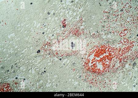 Amoeba parasite tissue under the microscope 200x Stock Photo - Alamy