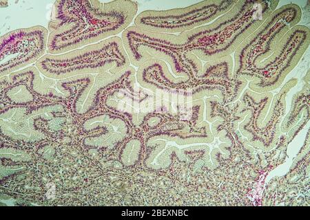 Large intestine with diverticular tissue under the microscope 100x ...