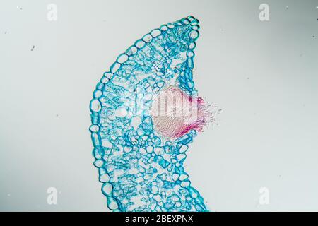 Rust fungus on milkweed plant, 200x Stock Photo - Alamy