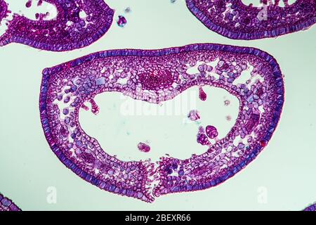 Heather leaf cross section under the microscope, 200x Stock Photo - Alamy