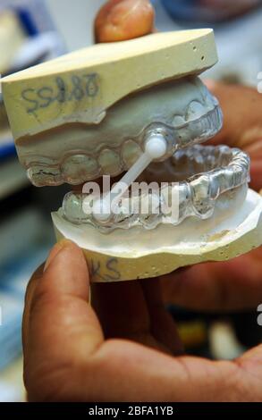 A mouth silencer which is used to help patiants with extreme problems ...