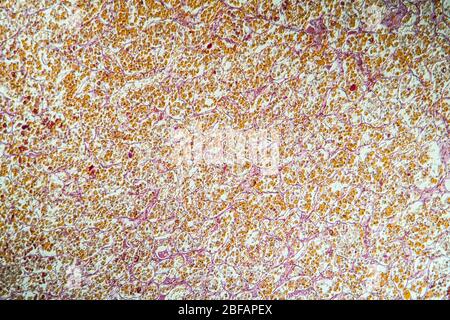 Pituitary pituitary gland under the microscope 100x Stock Photo - Alamy