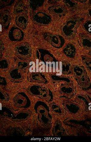 groin testicles tissue 100x Stock Photo - Alamy