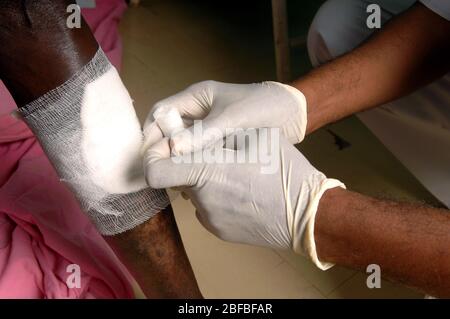 Squamous cell carcinoma SCC Stock Photo - Alamy