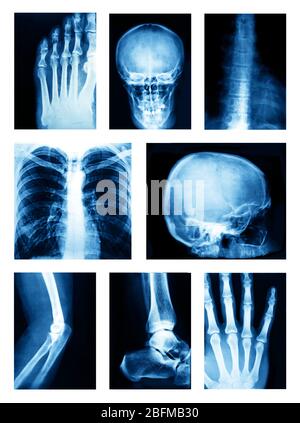 Collage of many X-rays Stock Photo - Alamy