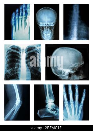 Collage of many X-rays Stock Photo - Alamy