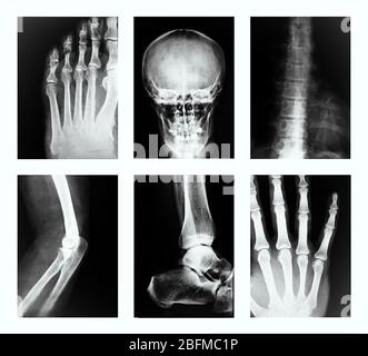 Collage of many X-rays Stock Photo - Alamy