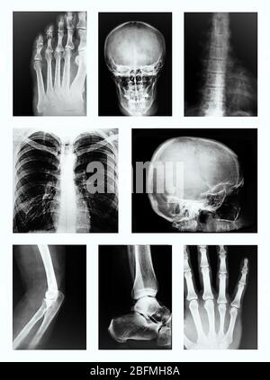 Collage of many X-rays Stock Photo - Alamy