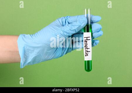 Test tube labeled Hepatitis in hand on green background Stock Photo - Alamy
