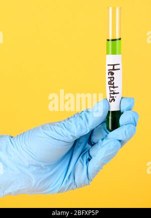 Test tube labeled Hepatitis in hand on beige background Stock Photo - Alamy