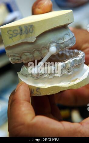 A mouth silencer which is used to help patiants with extreme problems ...