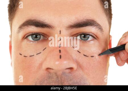 Plastic surgery concept. Hand marking male face Stock Photo - Alamy