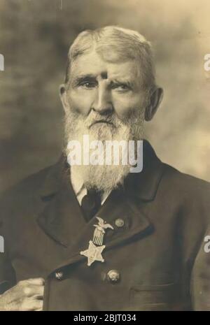 Civil War veteran Jacob Miller lived with an open gunshot wound to the ...