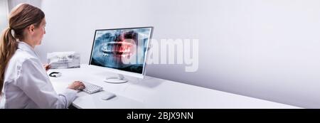 Dentist Looking At Teeth Xray Scan On Computer Stock Photo - Alamy