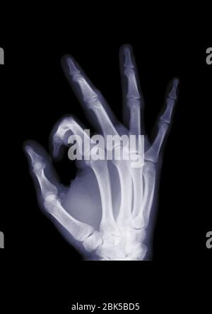 X-ray hand with OK symbol Stock Photo - Alamy