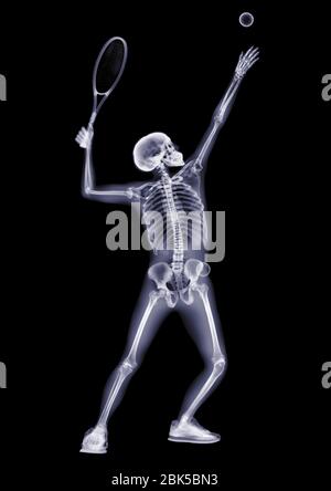 Tennis racket, X-ray Stock Photo - Alamy