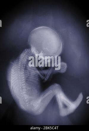 Human foetus in the womb, anatomical model of company Erler-Zimmer ...