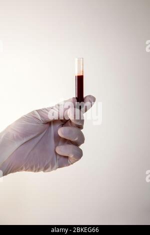 Blood sample. Gloved fingers holding a vacutainer tube of blood. A ...