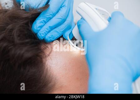 Trichoscopy of hair and scalp closeup. Trichoscope in the hands of a ...