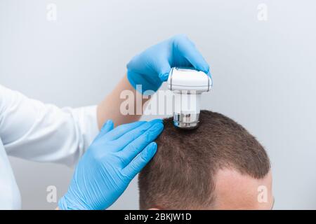 Trichoscopy of hair and scalp closeup. Trichoscope in the hands of a ...