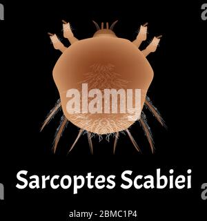 Sarcoptes scabiei. scabies. Sexually transmitted disease. Infographics ...