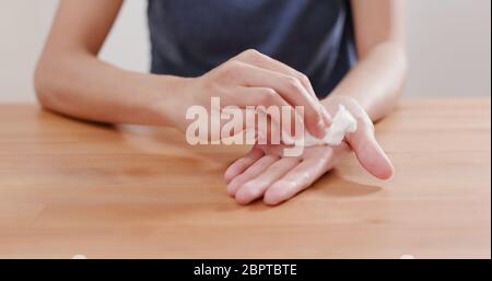 Woman suffer from hand perspiration Stock Photo - Alamy