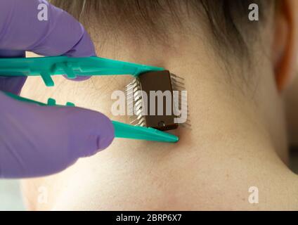implantation of a microchip under human skin. Human mind control using ...