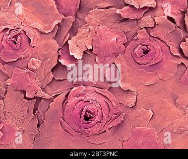 Sweat pore. Coloured scanning electron micrograph (SEM) of a sweat ...