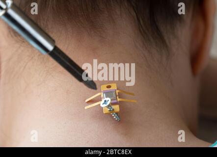 implantation of a microchip under human skin. Human mind control using ...
