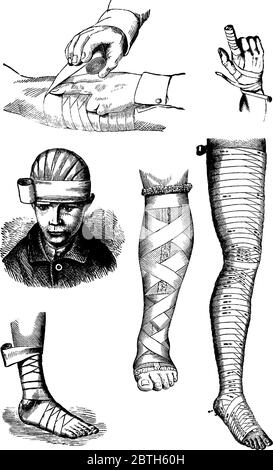 Different wound dressing bandages used to cover or scrape wounds, cuts ...