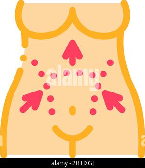 Tummy tuck plastic color icon. Abdominoplasty. Stomach liposuction ...