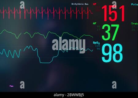 Close-up of EKG screen display Stock Photo - Alamy