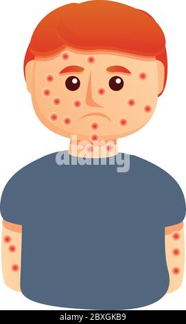 Chicken pox body icon. Cartoon of chicken pox body vector icon for web ...