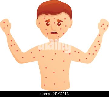 Boy skin rash icon. Cartoon of boy skin rash vector icon for web design ...