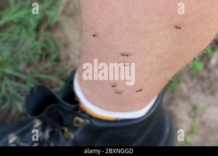 Several little ants on the foot of a man, the theme of insect bites, a ...