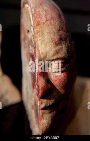 Body Works exhibition in Amsterdam,Netherlands Stock Photo - Alamy